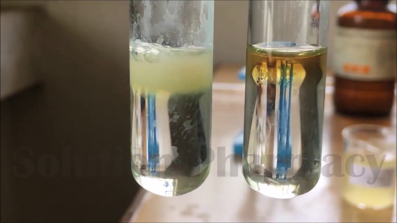Chemical examination of urine (Part -2) - Allied Guru